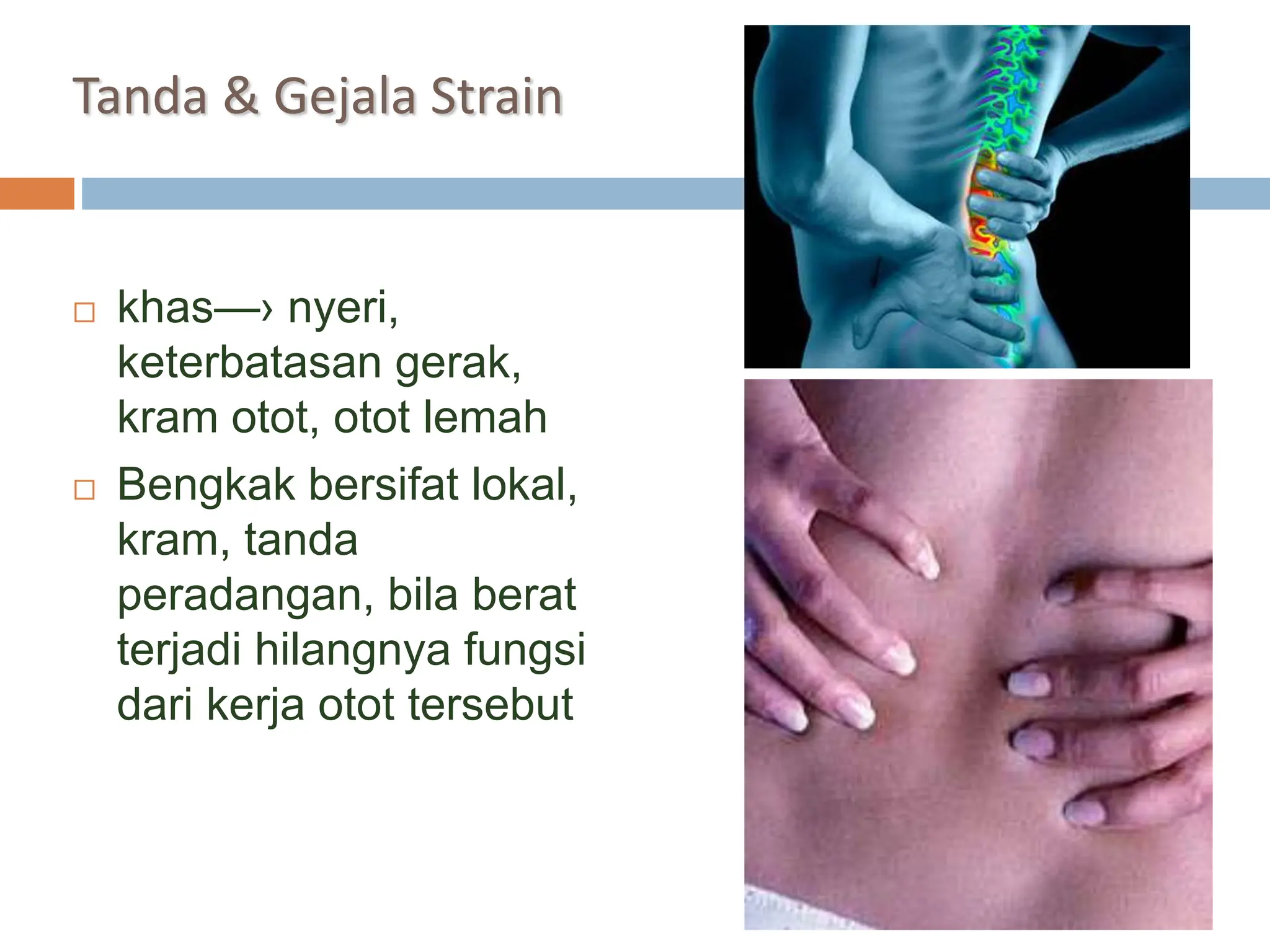 Upload a Presentation the Sprain Strain ppt | PPT