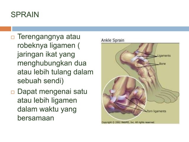 Upload a Presentation the Sprain Strain ppt | PPT
