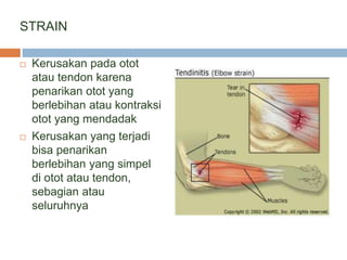 Upload a Presentation the Sprain Strain ppt | PPT