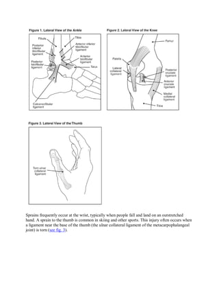 Sprain and Strain | PDF | Death, Injury, or Military Conflict ...