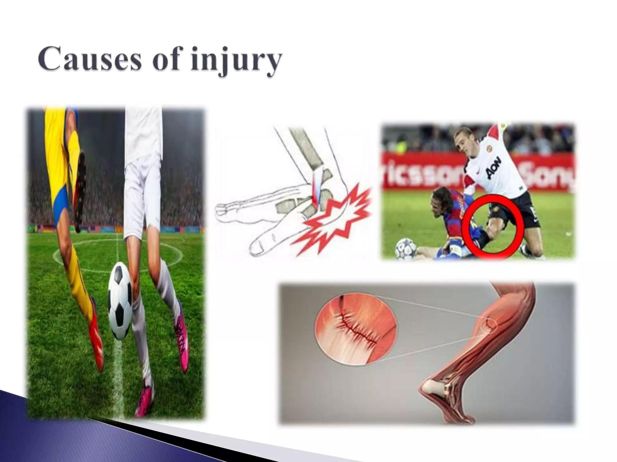 Sprain and Strain | PPTX