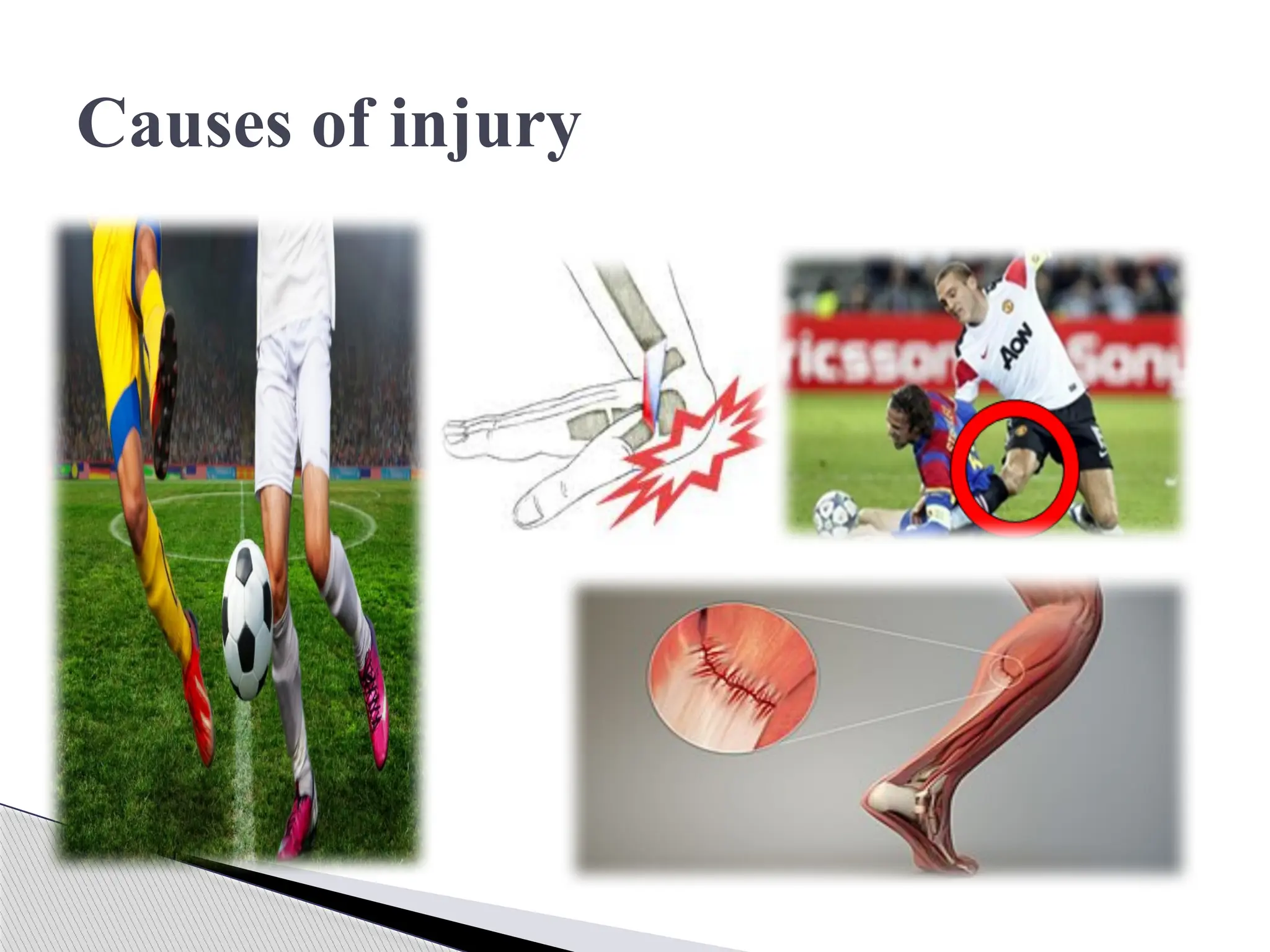 Emergency managemnts of strain and sprain.pptx