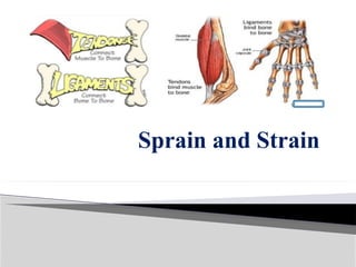 Emergency managemnts of strain and sprain.pptx