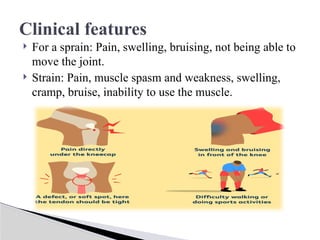 Emergency managemnts of strain and sprain.pptx