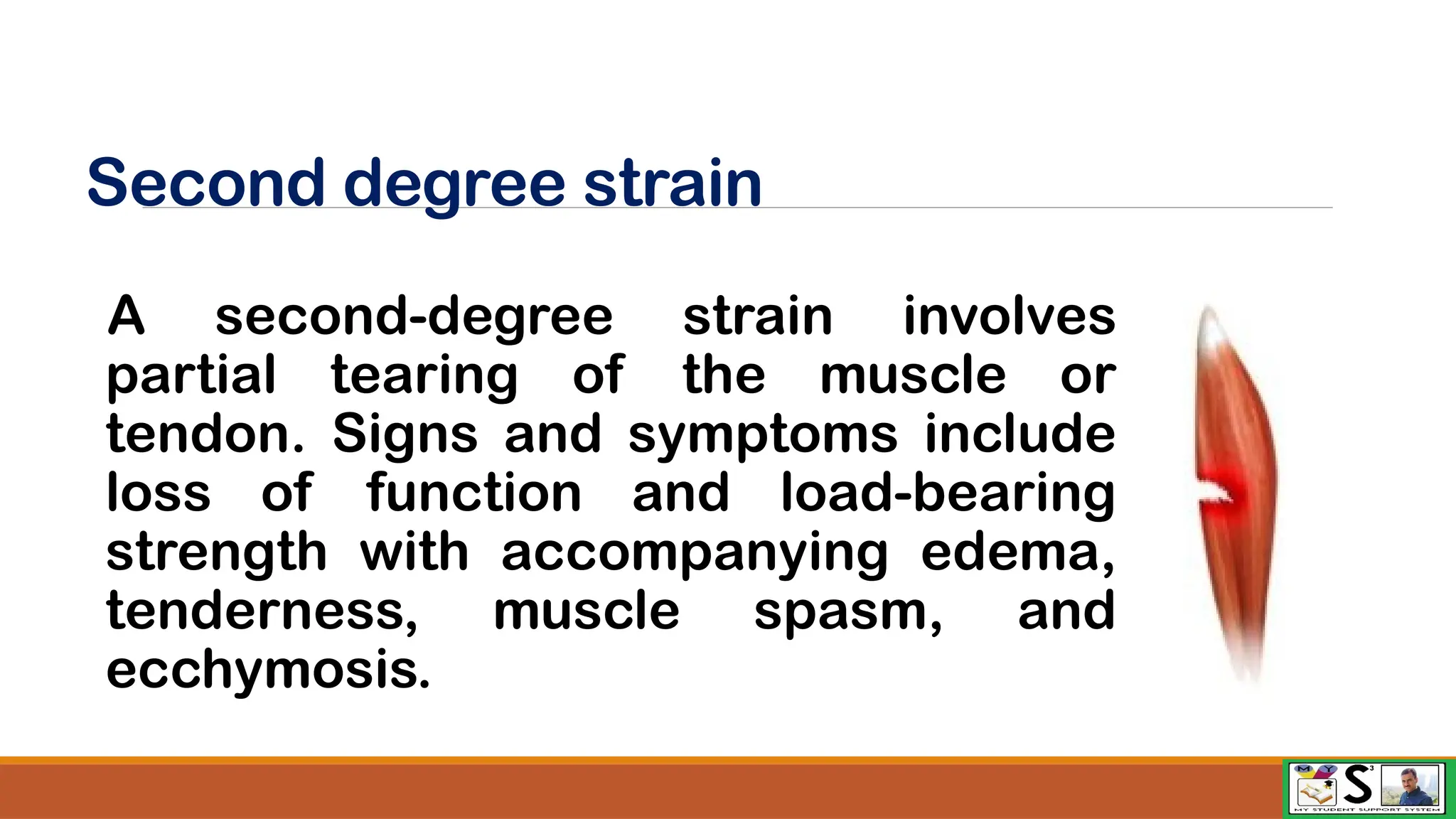 all about SPRAIN AND STRAIN IN ENGLISH.pptx