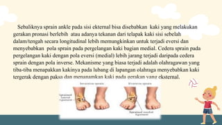 Sprain Ankle.pptx
