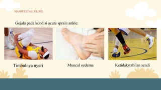 Sprain Ankle.pptx