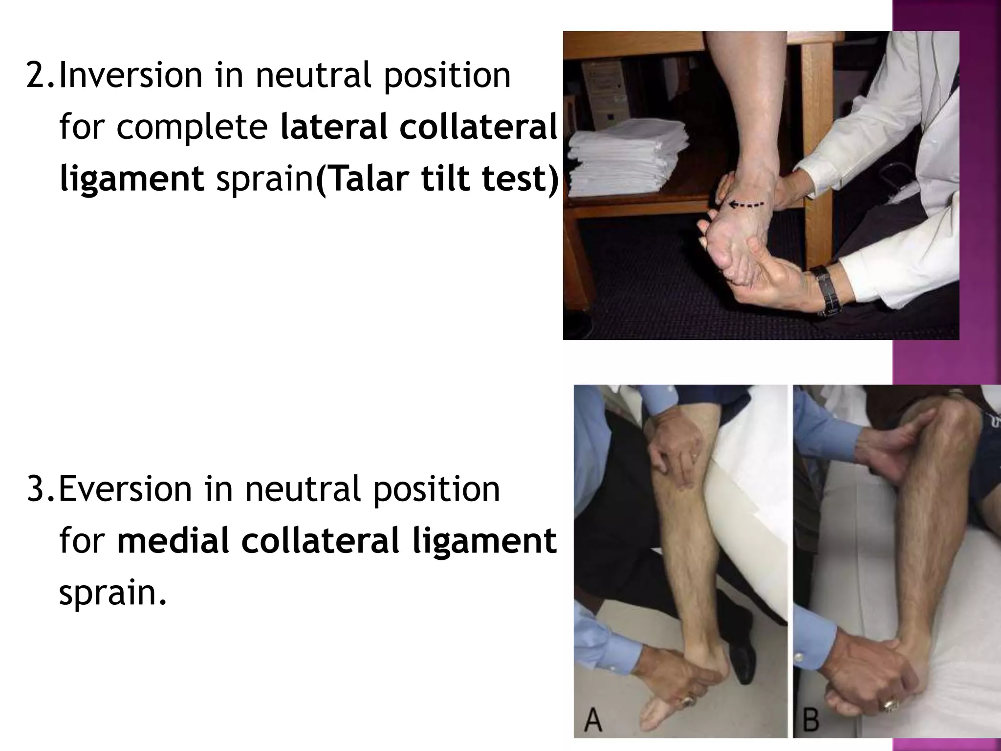SPRAINED ANKLE | PPTX