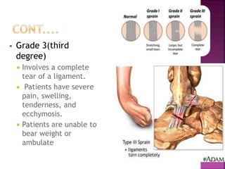 SPRAINED ANKLE | PPTX