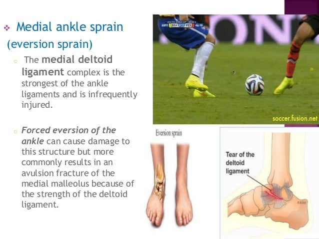 Eversion Of Ankle