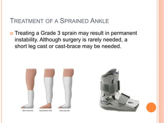 Sprained ankle powerpoint ashley dockstader | PPTX