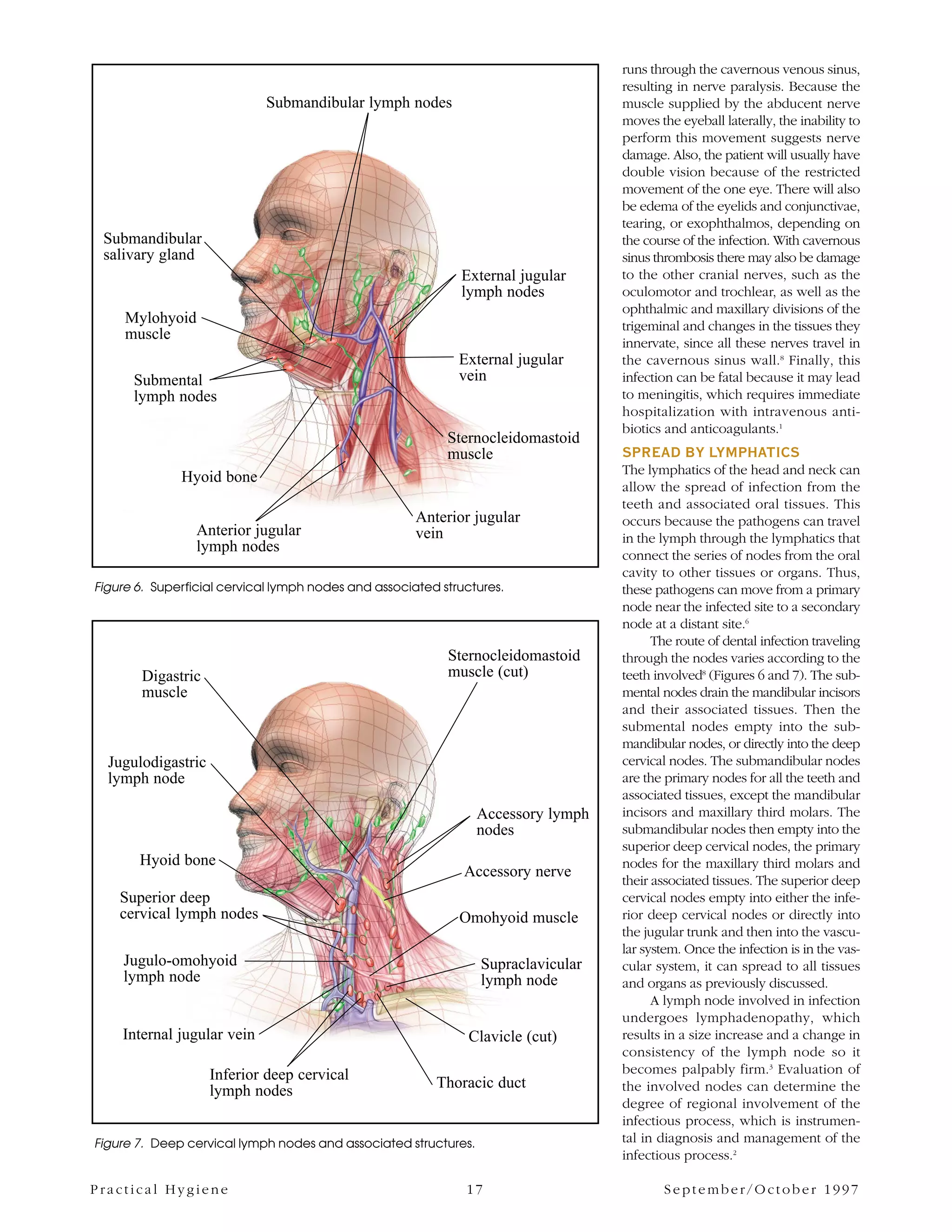 Spread of dental infection pdf | PDF