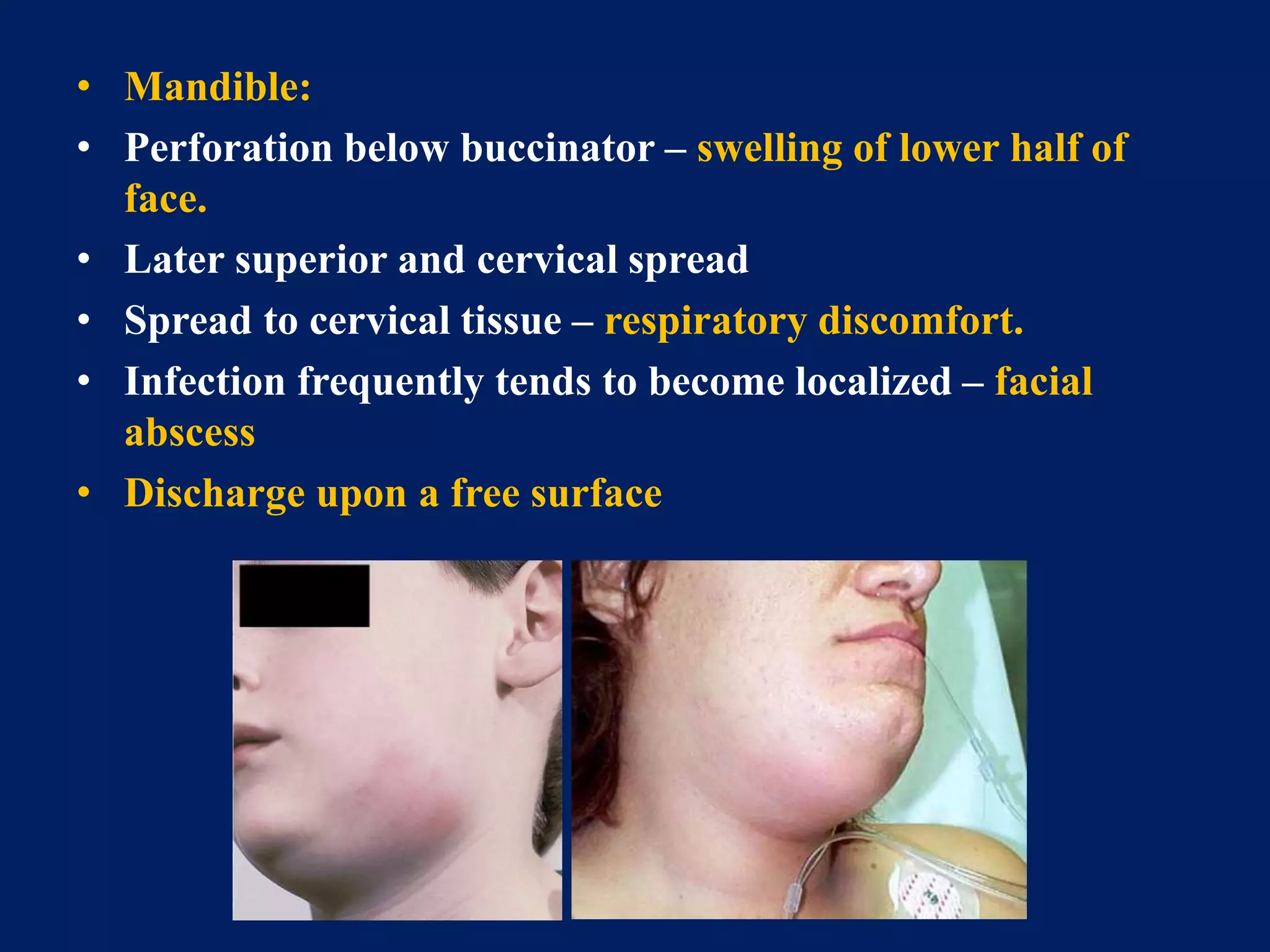 Spread of oral infections | PPTX