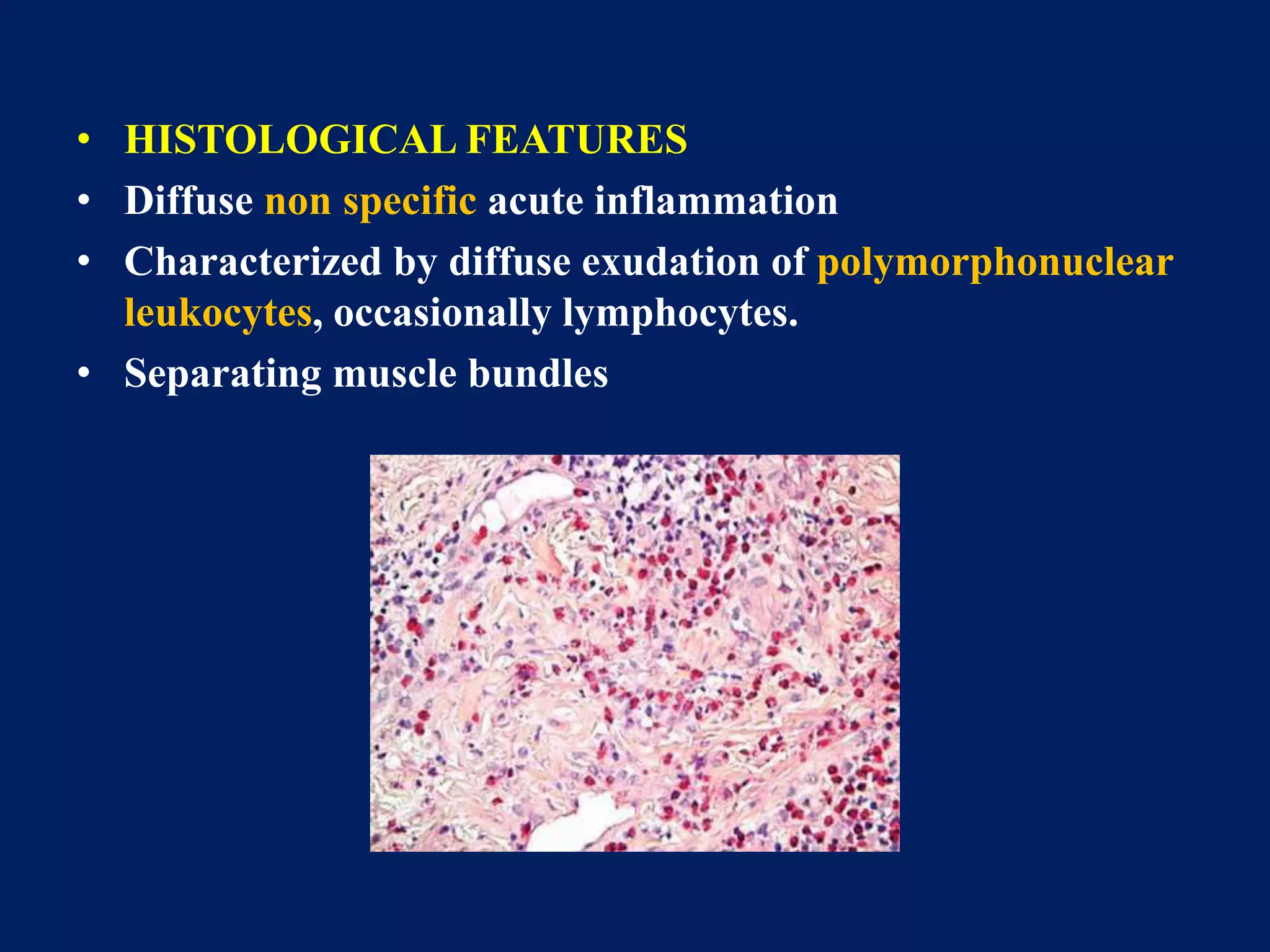 Spread of oral infections | PPTX