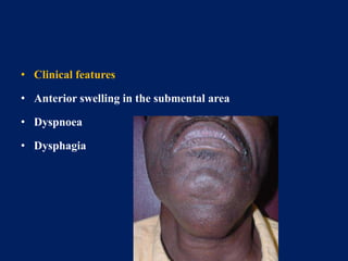 Spread of oral infections | PPTX