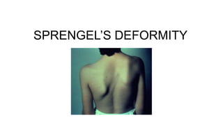 Sprengel deformity presentation by doctor | PPTX