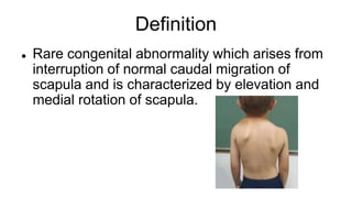 Sprengel deformity presentation by doctor | PPTX