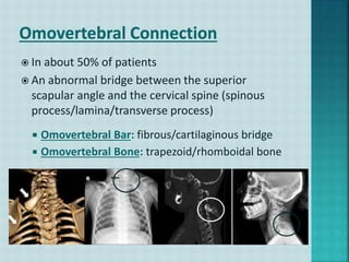 SPRENGEL SHOULDER.pptx