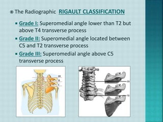 SPRENGEL SHOULDER.pptx