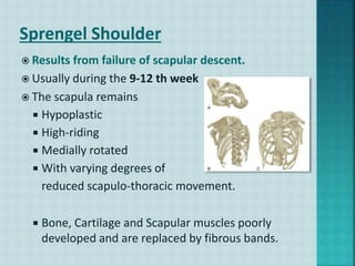 SPRENGEL SHOULDER.pptx