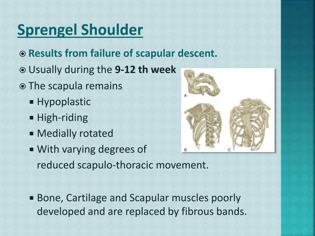 SPRENGEL SHOULDER.pptx | Death, Injury, or Military Conflict ...