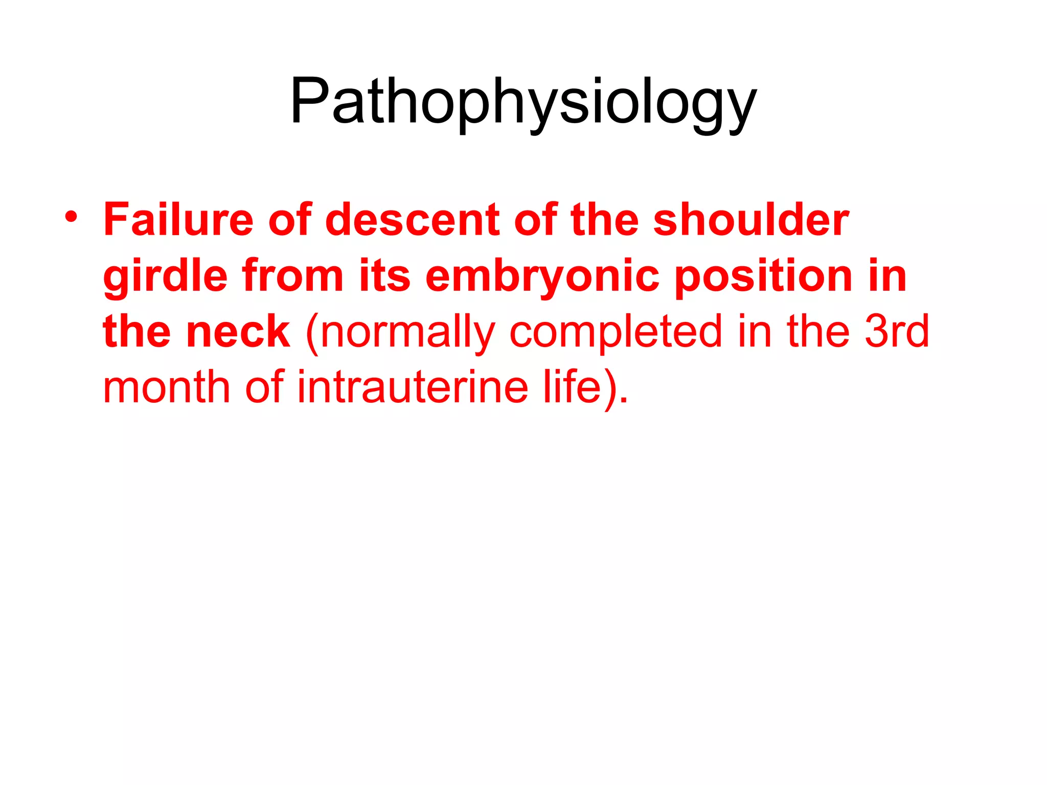 Sprengel's shoulder | PPT
