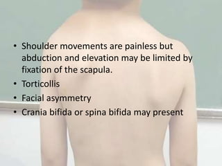 Sprengel’s shoulder | PPTX