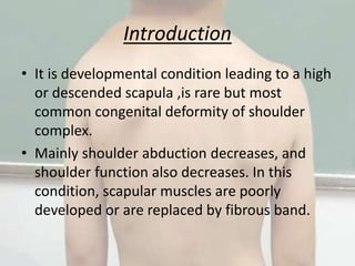 Sprengel’s shoulder | PPTX