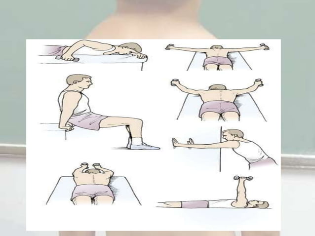 Sprengel’s shoulder | PPTX