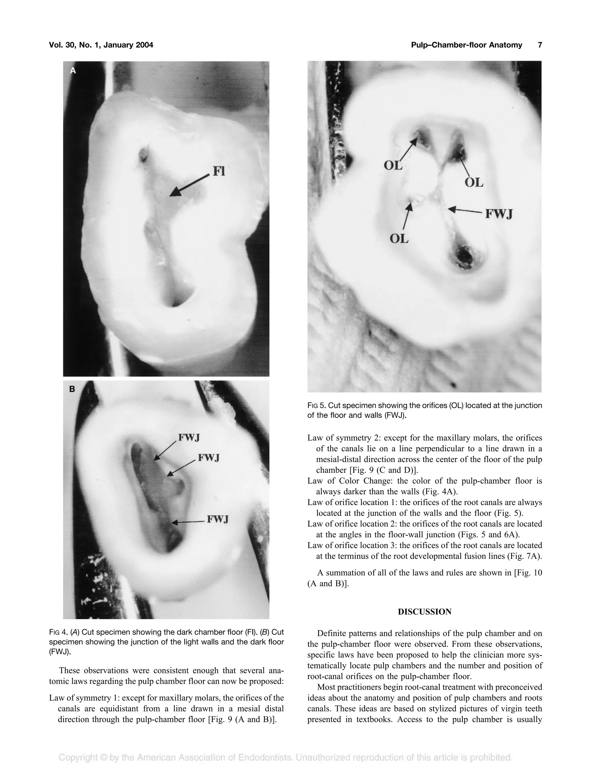 anatomy of the pulp-chamber floor | PDF
