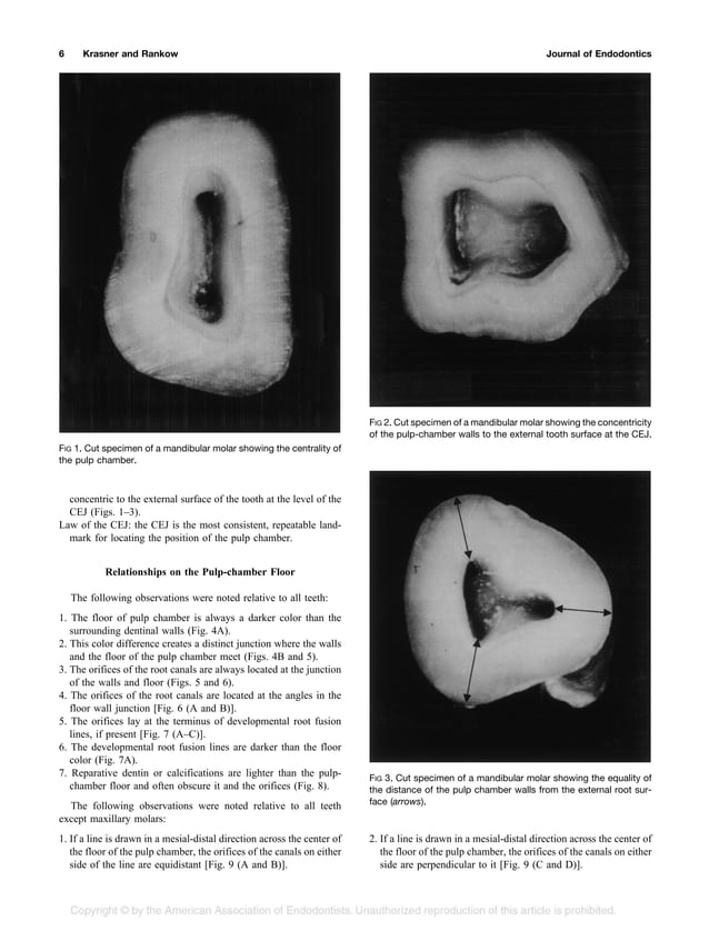 anatomy of the pulp-chamber floor | PDF