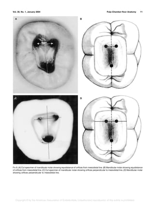 anatomy of the pulp-chamber floor | PDF