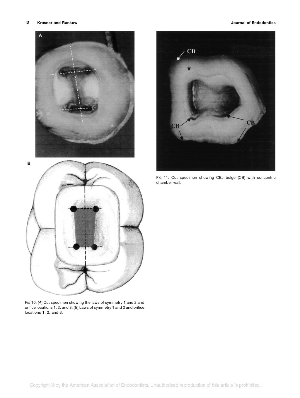 anatomy of the pulp-chamber floor