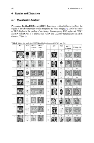 Hybrid Pixel-Based Method for Multimodal Medical Image Fusion Based on Integration of Pulse ...