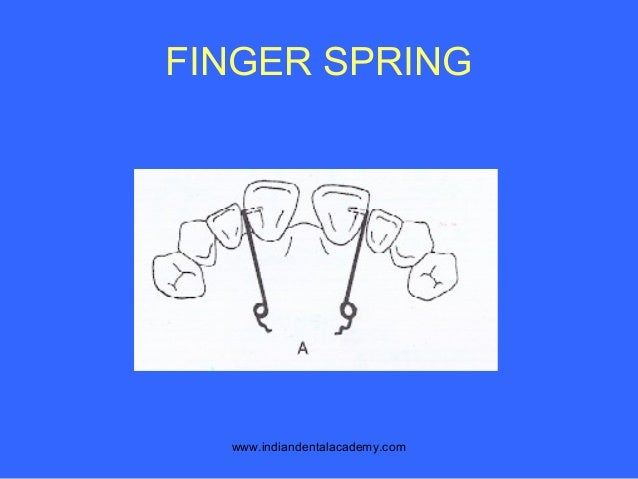 Springs /certified fixed orthodontic courses by Indian dental academy