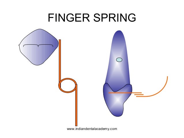 Springs /certified fixed orthodontic courses by Indian dental academy