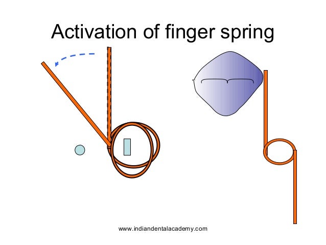 Springs /certified fixed orthodontic courses by Indian dental academy