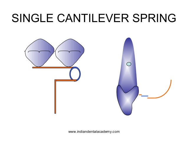 Springs /certified fixed orthodontic courses by Indian dental academy