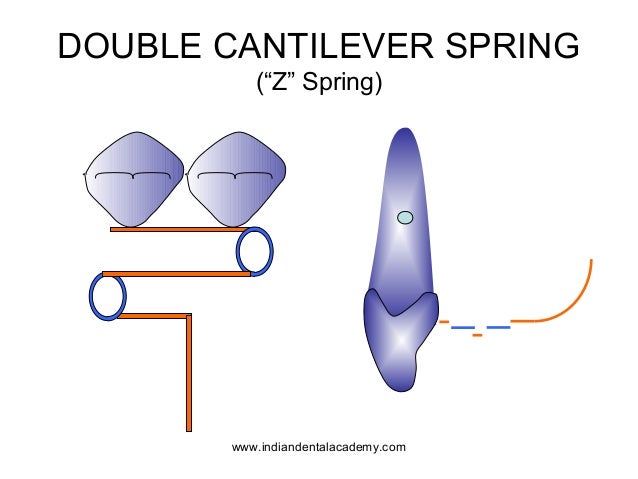 Springs /certified fixed orthodontic courses by Indian dental academy