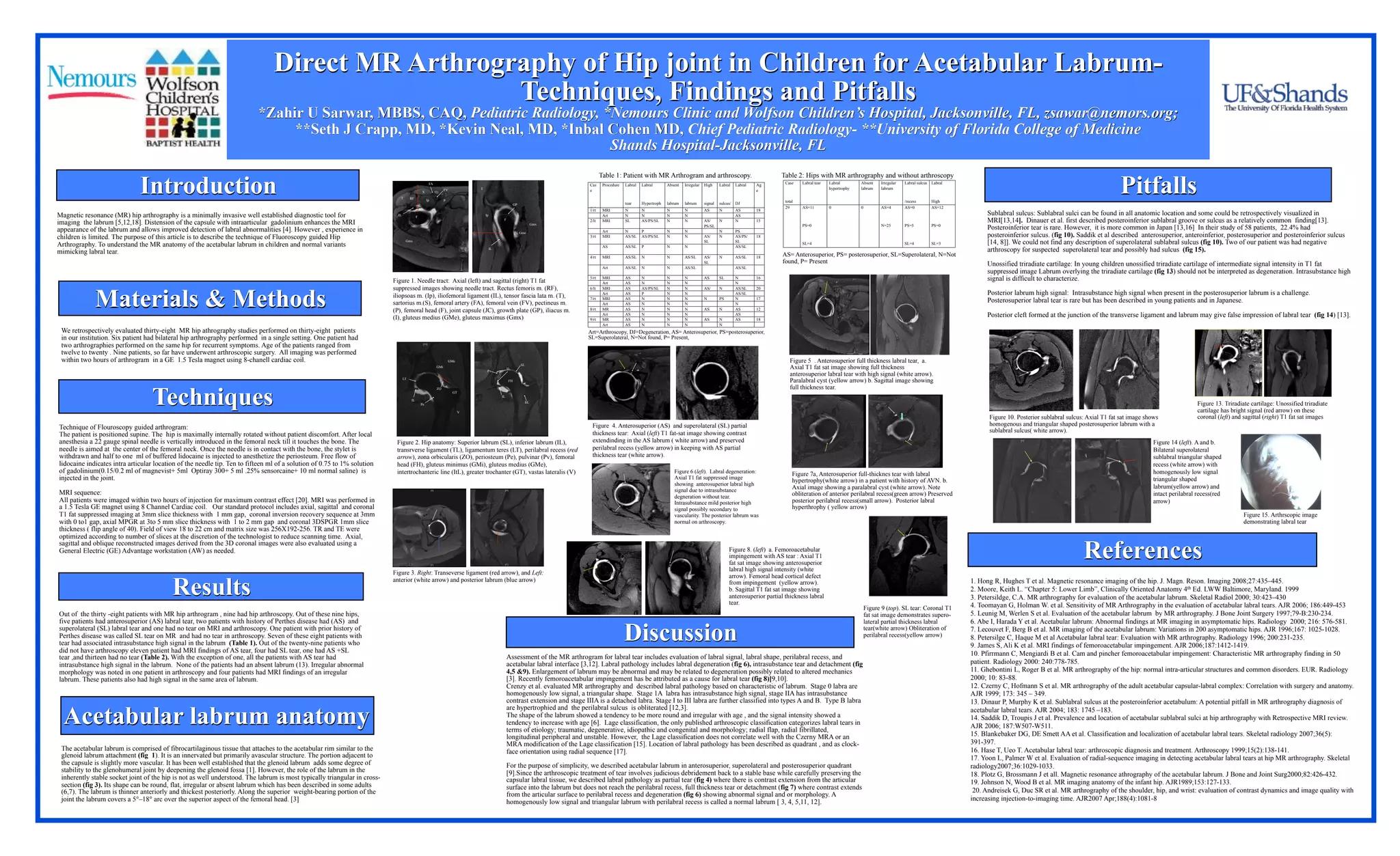 Direct MR Arthrography of Hip joint in Children for Acetabular Labrum ...