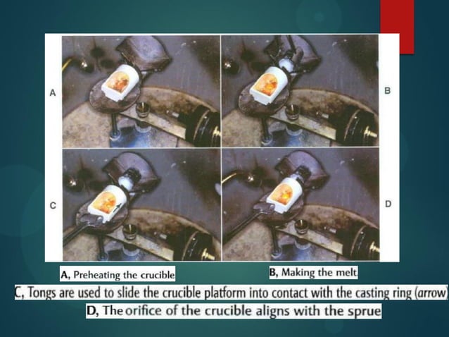 Spruing,casting and investing | PDF