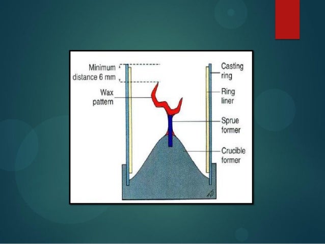 Spruing,casting and investing