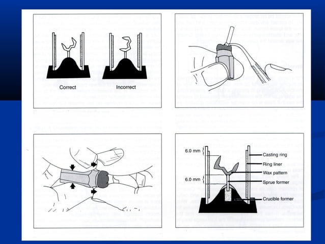 Spruing and investing | PPT