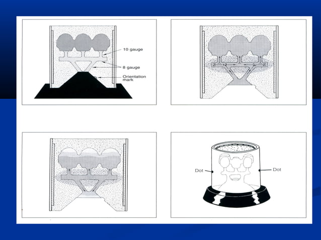 Spruing and investing | PPT