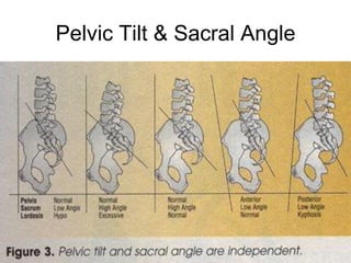 Sps451 t10 body mechanics-lbp | PPT