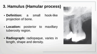SPS budur Nitration: Anisole SystemReailab | PPT