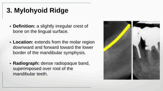 SPS budur Nitration: Anisole SystemReailab | PPT