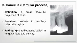 SPS budur.pptx_20240505_041401_٠٠٠٠.pptx