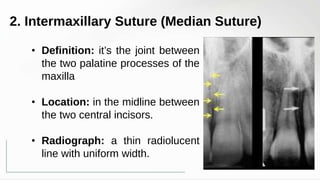 SPS budur.pptx_20240505_041401_٠٠٠٠.pptx