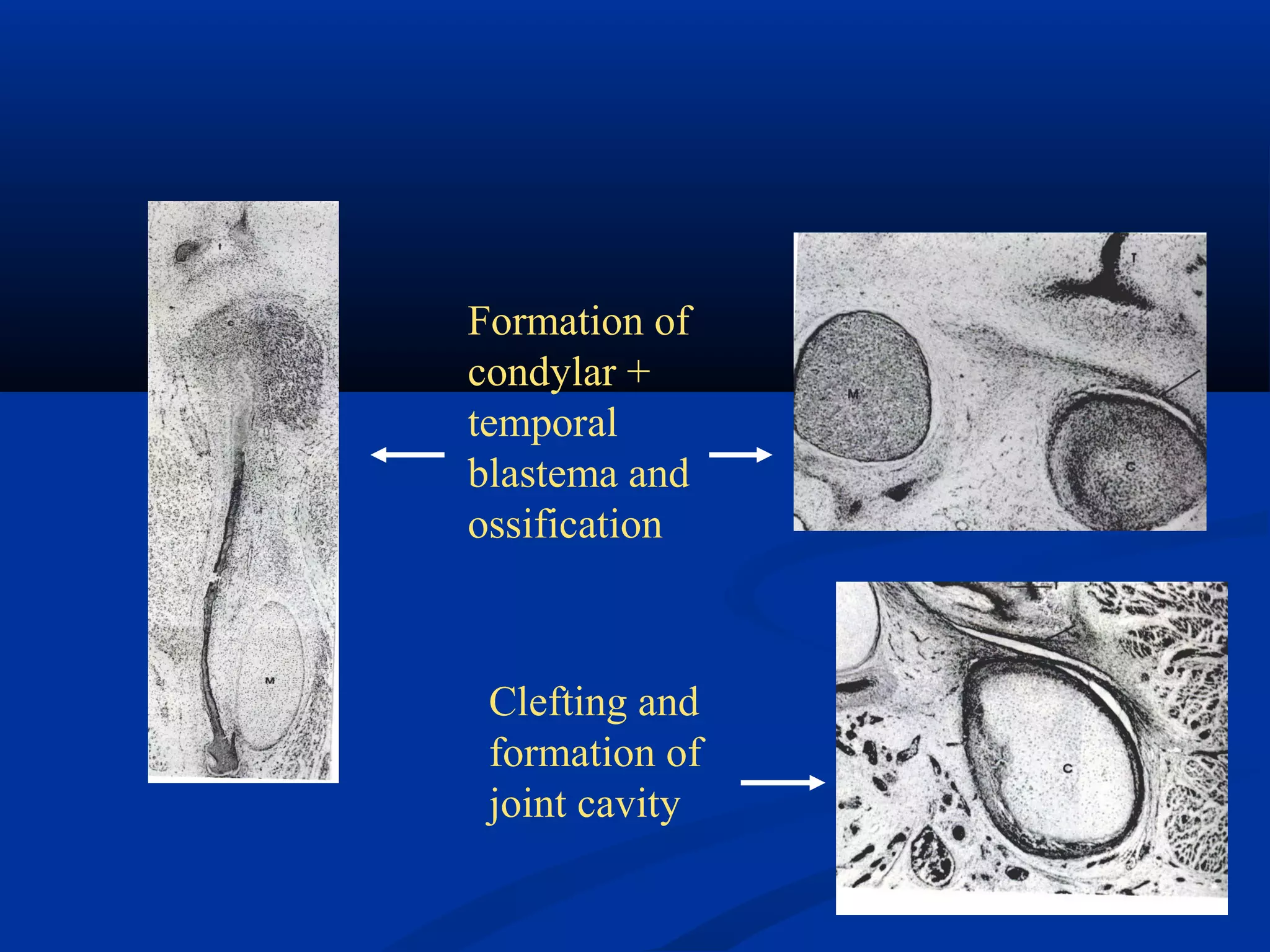 temporomandibular joint-development and anatomy | PPT